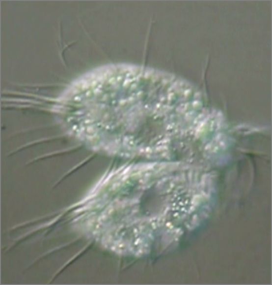 滴虫界 (Infusorian World）Ciliates，Amoebae，Flagellates，etc... : 繊毛虫 ...