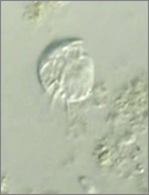 滴虫界 (Infusorian World）Ciliates，Amoebae，Flagellates，etc... : Aspidisca ...