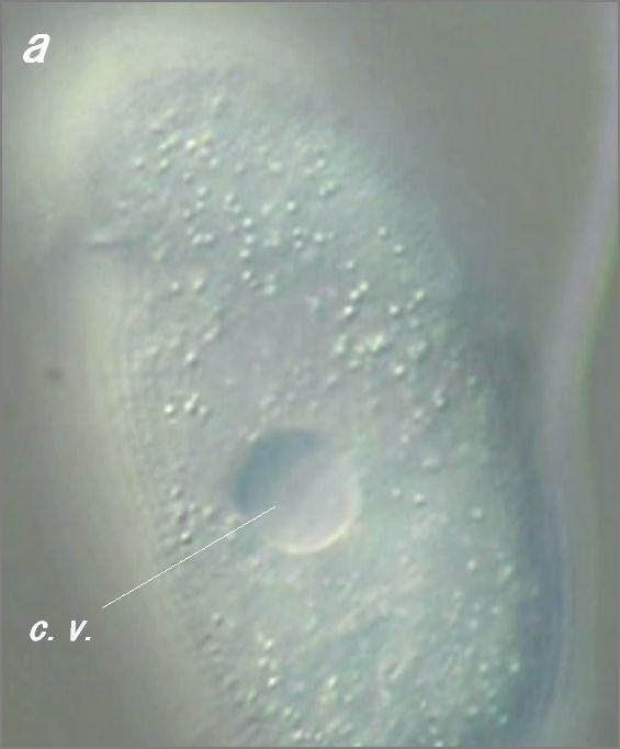 滴虫界 (Infusorian World）Ciliates，Amoebae，Flagellates，etc... : Colpidium ...