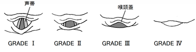 Q：Cormack-Lehane 分類とは？ : 麻酔科勤務医のお勉強日記