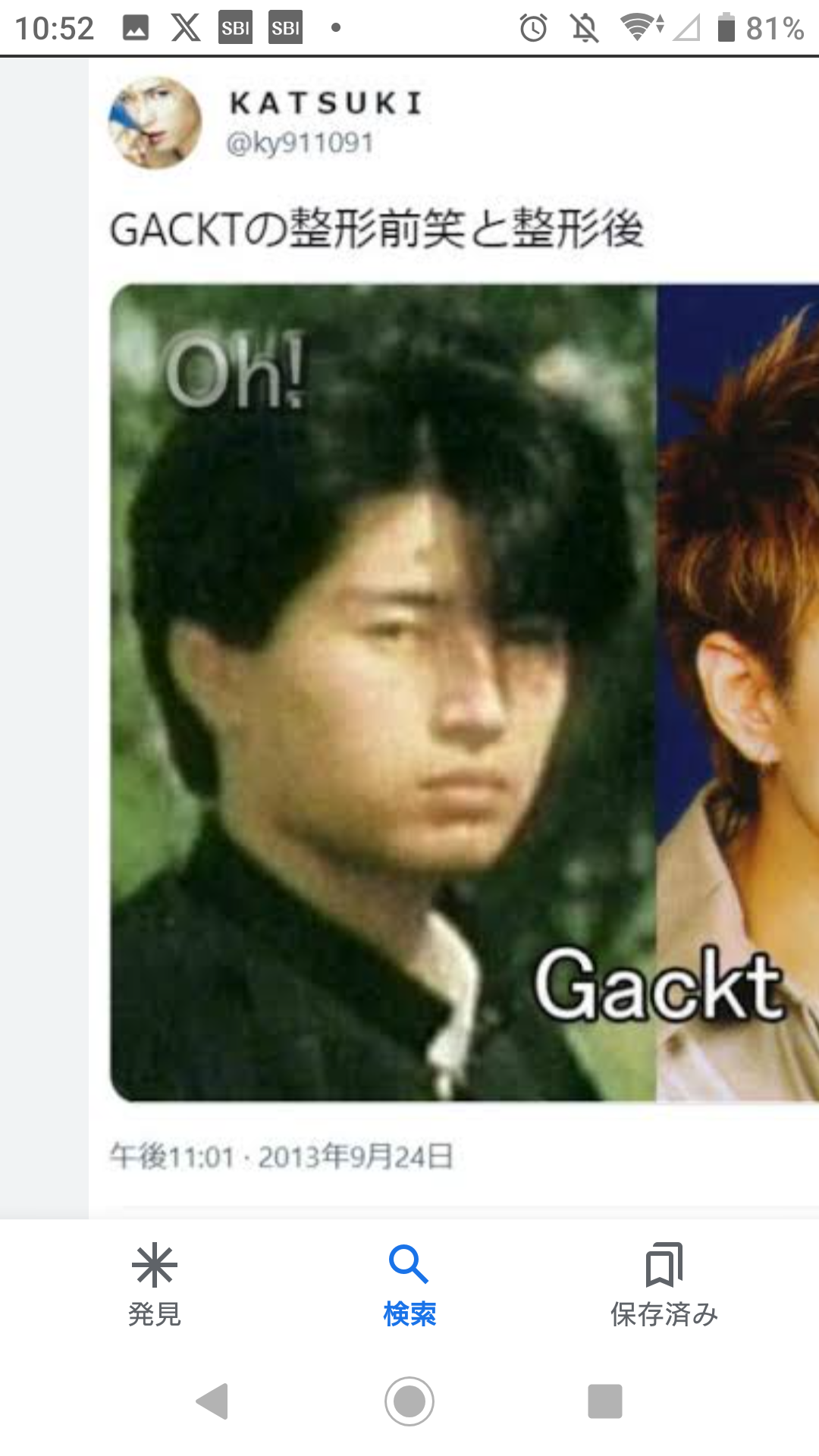 【芸能】GACKT「整形じゃブスは治らない」美容整形で持論 「ブスは外見じゃなく中身の問題」 : まるホラ速報