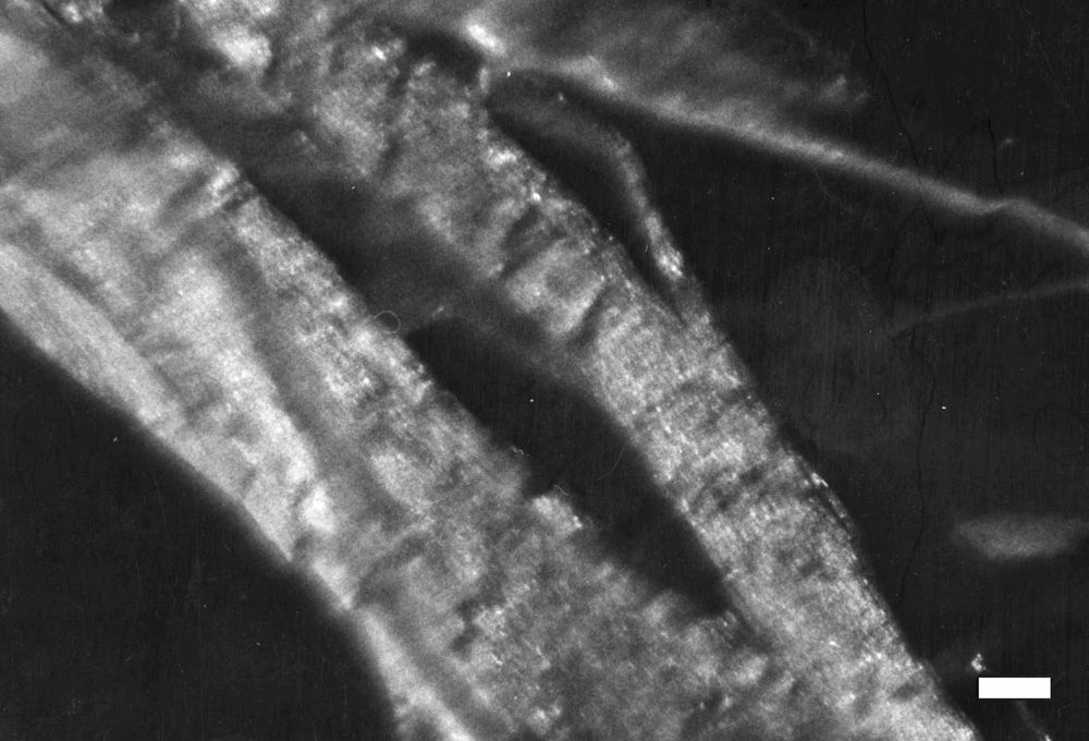 [#1485] 全芳香族ポリアミド繊維（Kevlar）の軸圧縮・軸破壊(21) PBT繊維の(hk0)暗視野像 : 高分子-ミクロの世界-