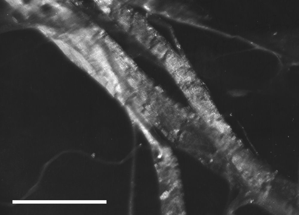 [#1485] 全芳香族ポリアミド繊維（Kevlar）の軸圧縮・軸破壊(21) PBT繊維の(hk0)暗視野像 : 高分子-ミクロの世界-