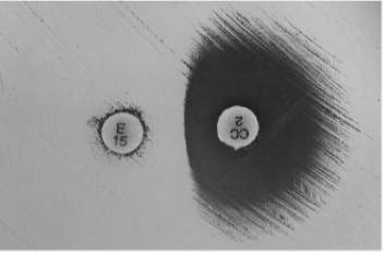 黄色ブドウ球菌のD-zone test : 今日なに読もう〜病院総合診療医の論文ブログ〜