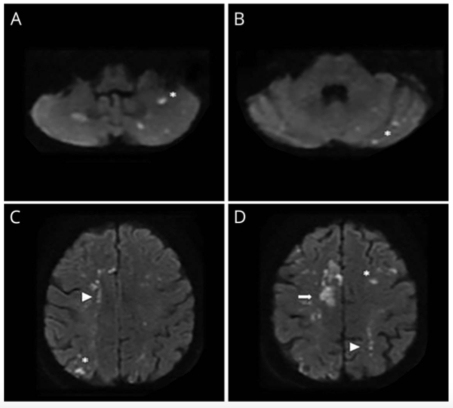 Three Territory Signについて : 今日なに読もう〜病院総合診療医の論文ブログ〜
