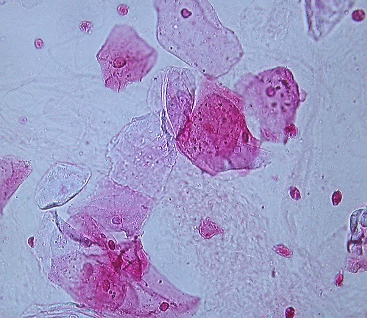 こどもの病気・おとなの病気:おとなの疾患