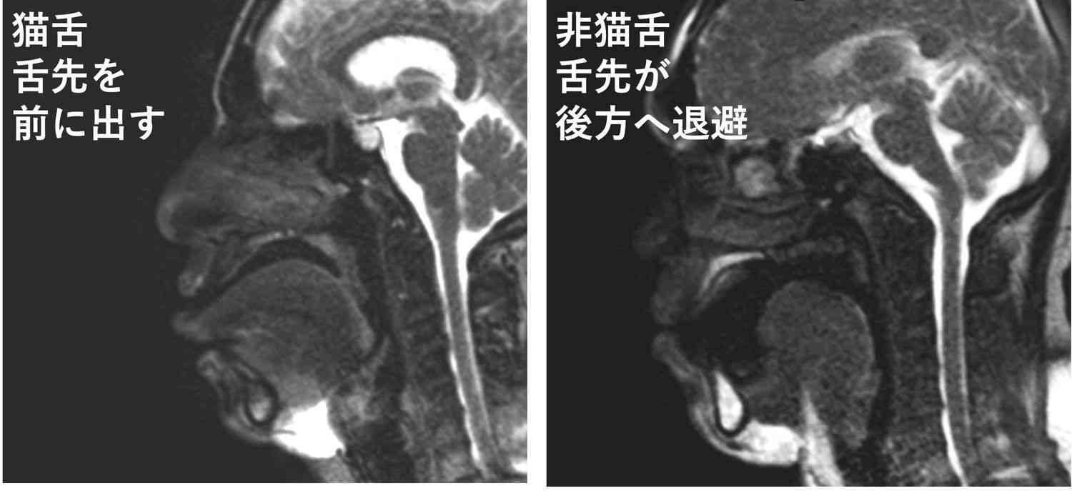 「猫舌」を徹底的に研究してわかった“そうでない人”の決定的な違いがヤバすぎるwwwww（画像あり） : 【2ch】ニュー速クオリティ