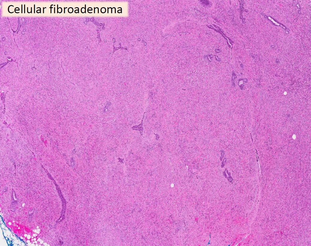 南に吹く風 : 10th SGH Breast Pathology Course 2019 (1)