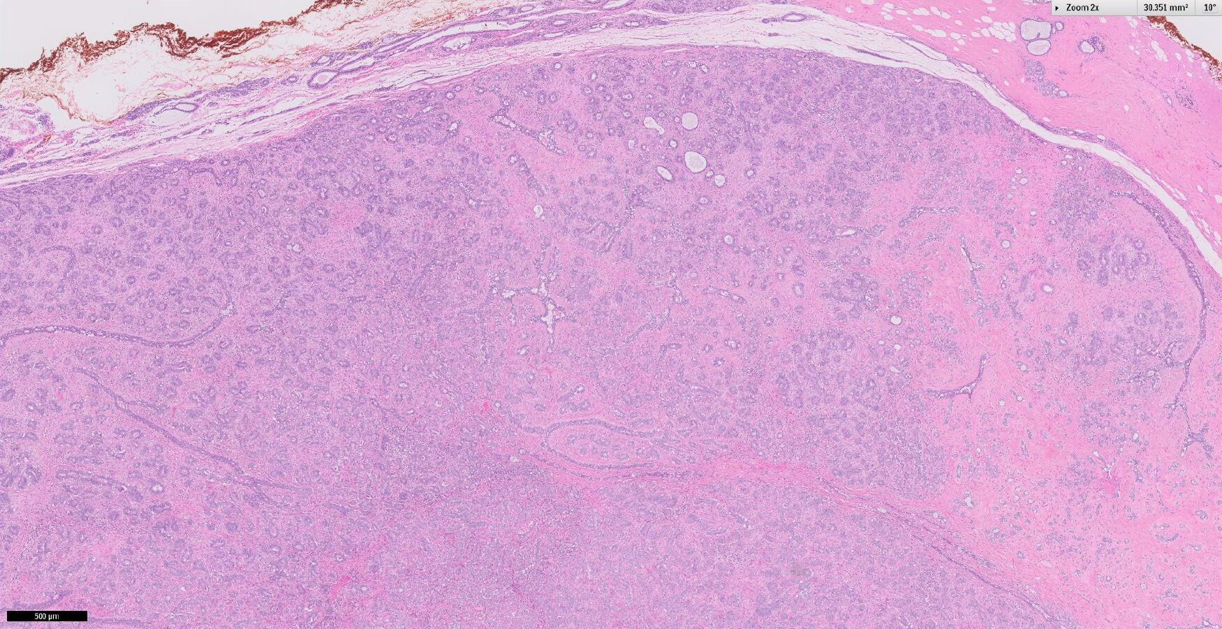 南に吹く風 : 10th SGH Breast Pathology Course 2019 (2)