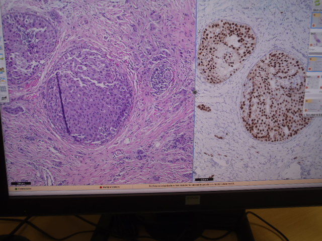 南に吹く風 : Digital Pathology in SGH (2013)