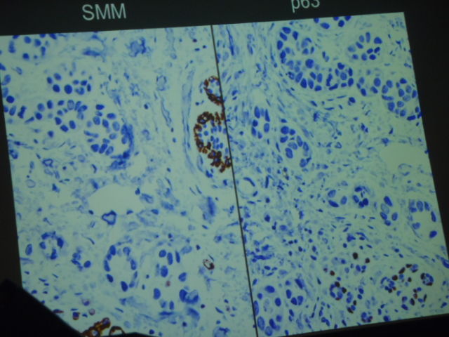 南に吹く風 : 6th SGH Breast Pathology Course 2015