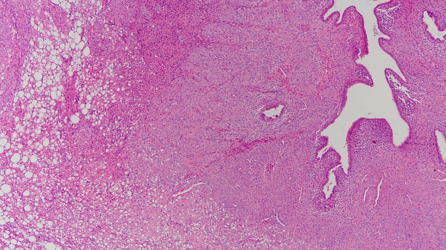南に吹く風 : 10th SGH Breast Pathology Course 2019 (1)