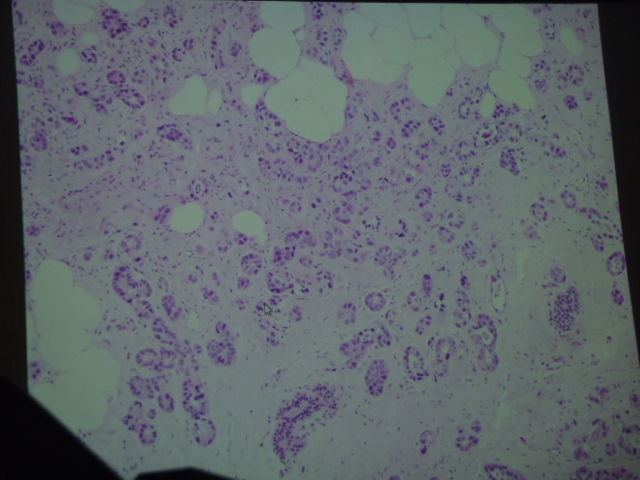 南に吹く風 : 6th SGH Breast Pathology Course 2015