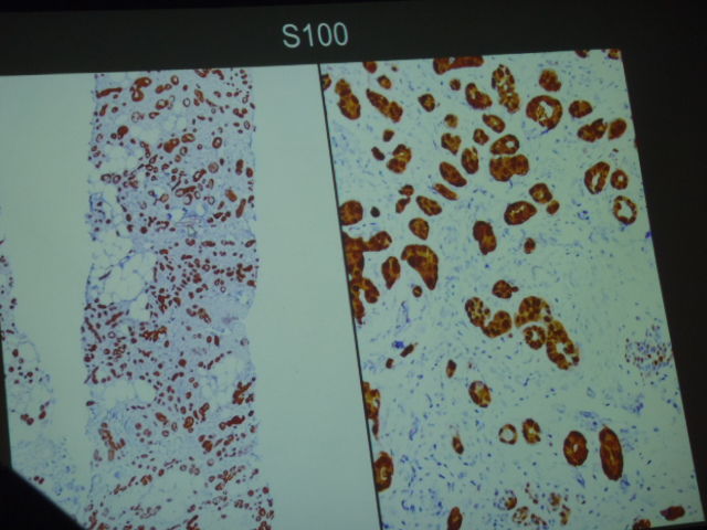 南に吹く風 : 6th SGH Breast Pathology Course 2015