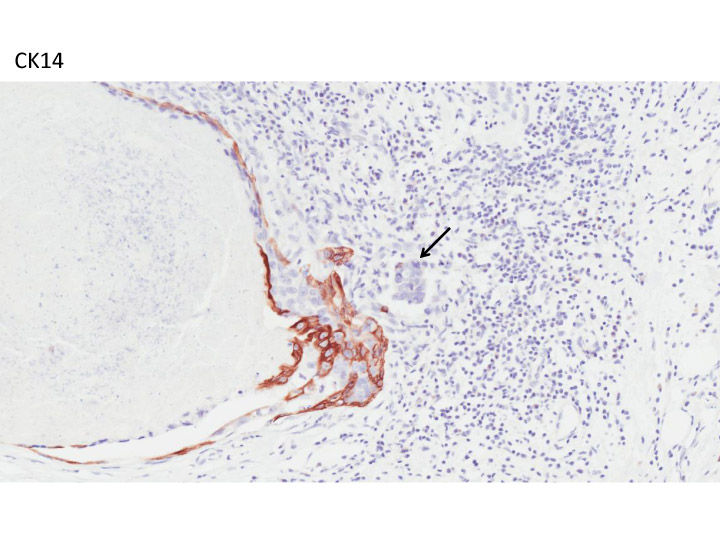 南に吹く風 : SGH Breast Pathology Course 2012 (2)