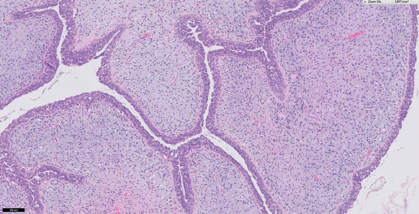 南に吹く風 : 10th SGH Breast Pathology Course 2019 (2)