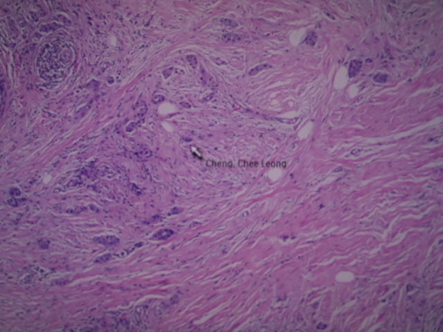 南に吹く風 : Digital Pathology in SGH (2013)