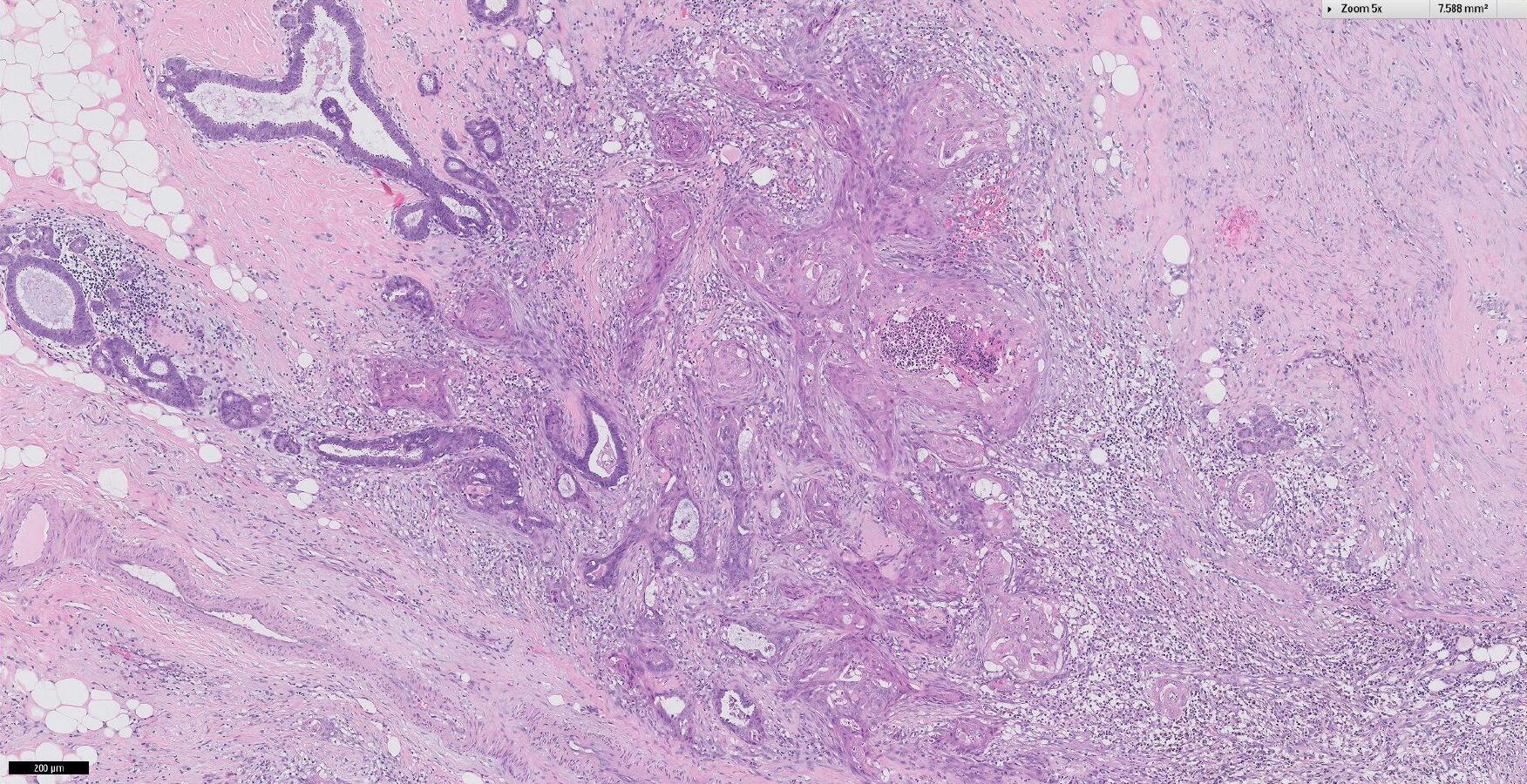 南に吹く風 : 10th SGH Breast Pathology Course 2019 (2)