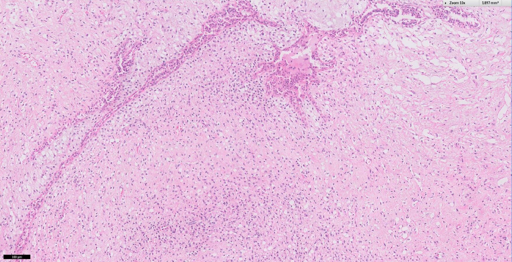南に吹く風 : 10th SGH Breast Pathology Course 2019 (2)