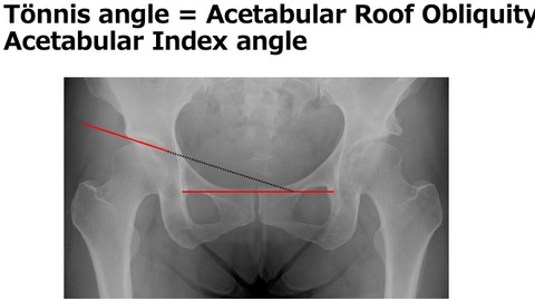 第18回 北九州スポーツ整形外科研究会のご案内 : スポーツ整形外科医S. Uのブログ Sports Physician S.U Blog