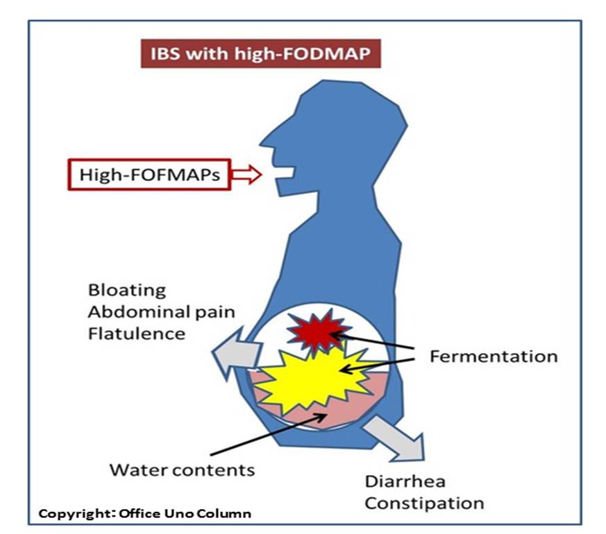 Atlas of Gut Gas in IBS : 宇野コラム Uno column