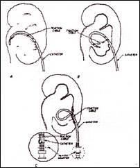 2013年08月14日 : 宇野コラム Uno column