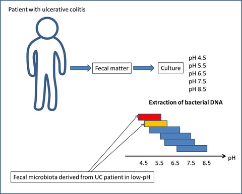 Identification of the pathogen of ulcerative colitis : 宇野コラム Uno column